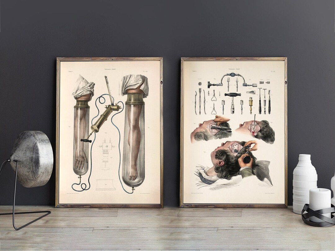 Surgical Poster, Doctor Office Decor, Surgeon Gift, Vintage Medical ...