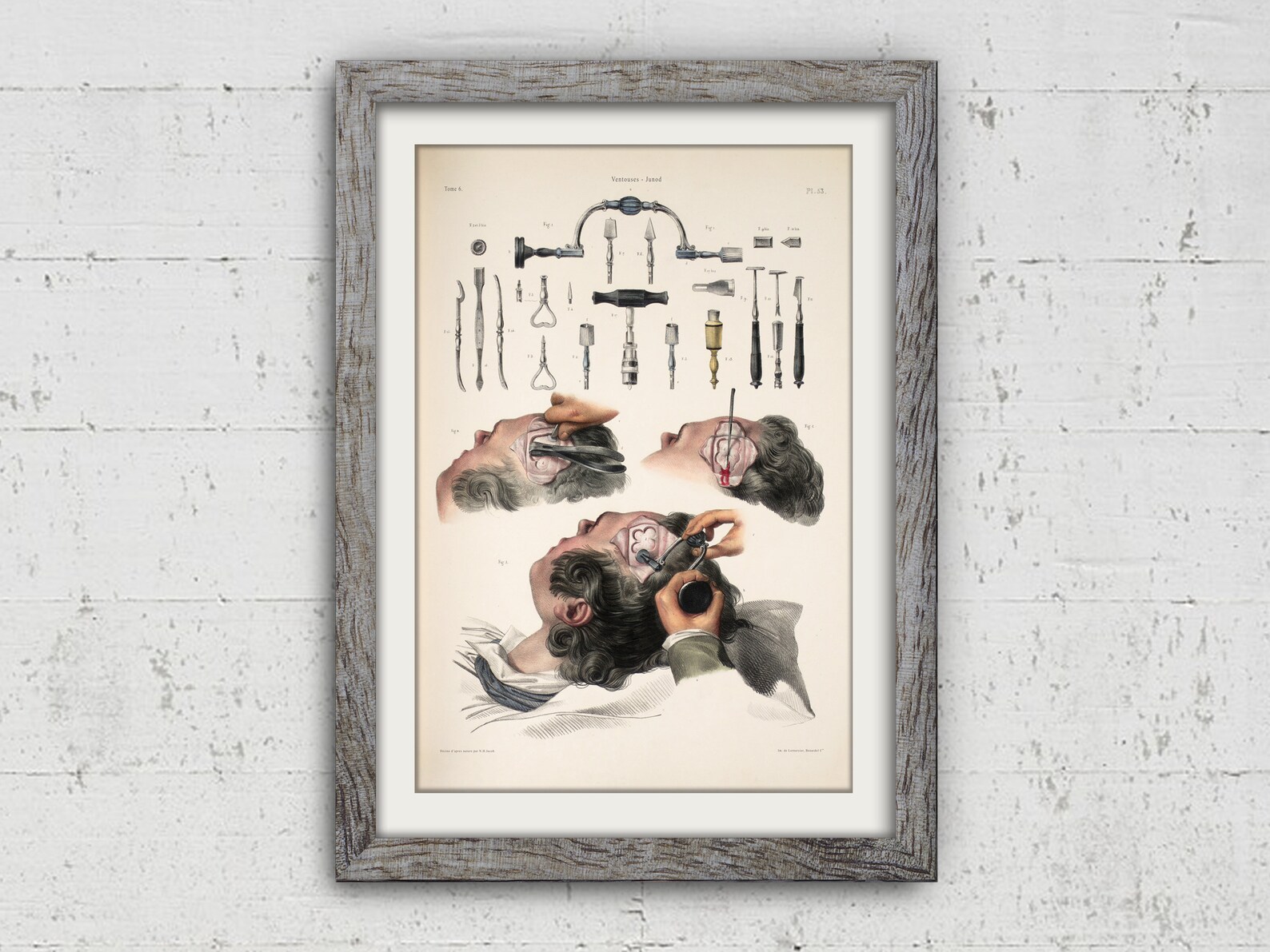 Surgical Poster, Doctor Office Decor, Surgeon Gift, Vintage Medical ...