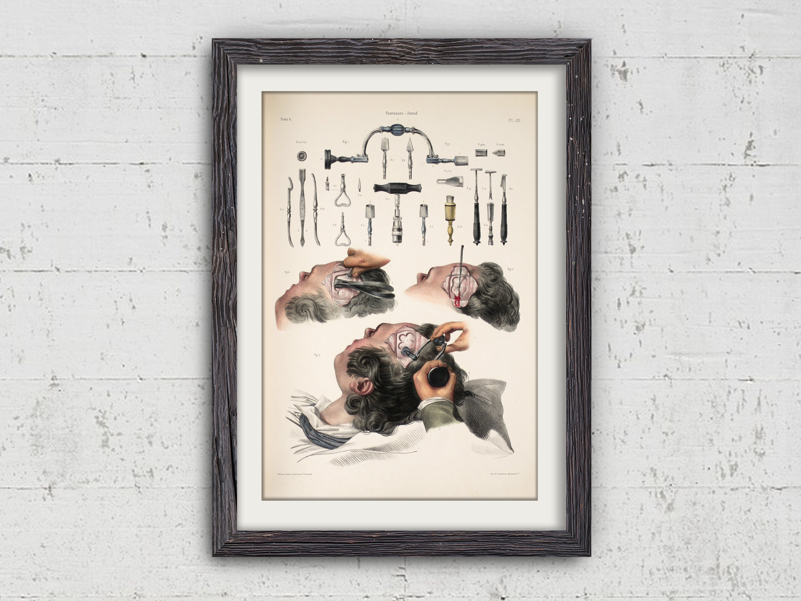 Surgical Poster, Doctor Office Decor, Surgeon Gift, Vintage Medical ...
