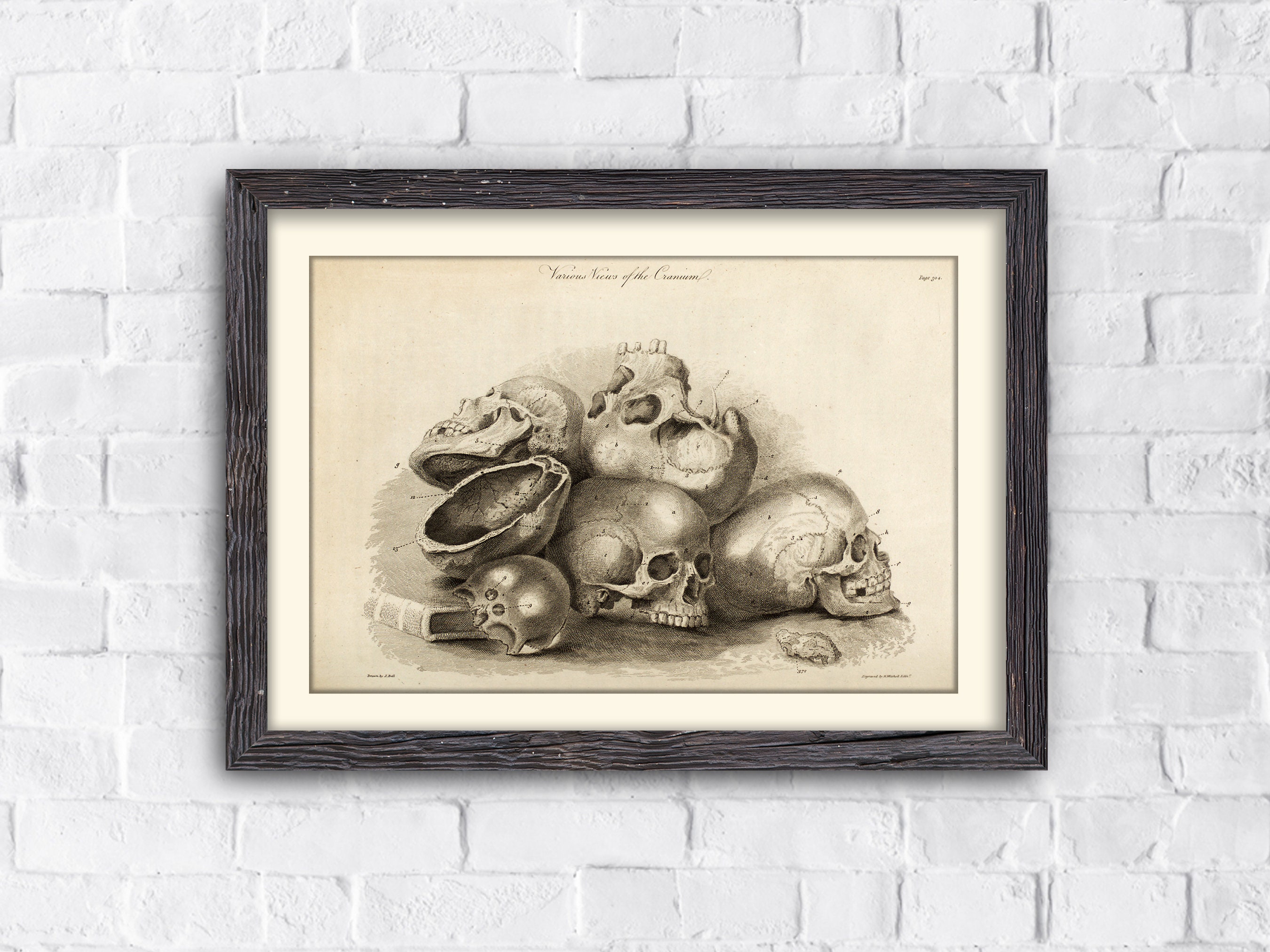 Vintage Scull Plate, Antique Scull Poster. Medical Gift, Antique Decor ...