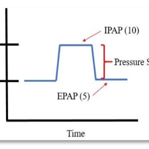 BIPAP Quick Reference Guide - Etsy