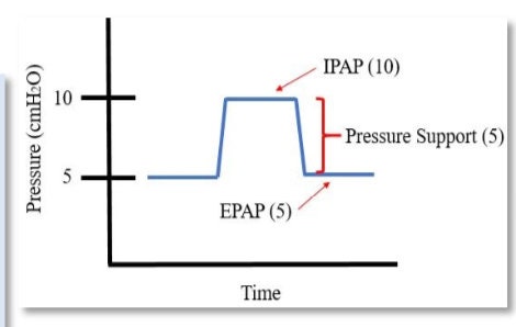 BIPAP Quick Reference Guide - Etsy