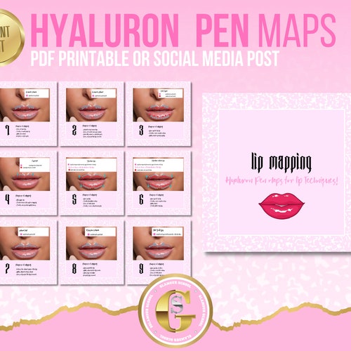 Hyaluron Pen Lip Mapping Lip Map Lip Mapping Techniques - Etsy Canada