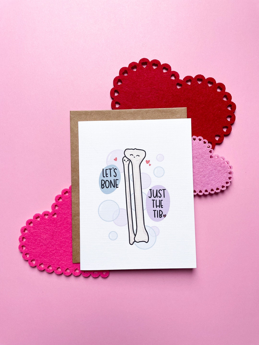 Let's Bone / Just the Tib - Valentine's Day, Orthopaedic Surgeon, Bone ...