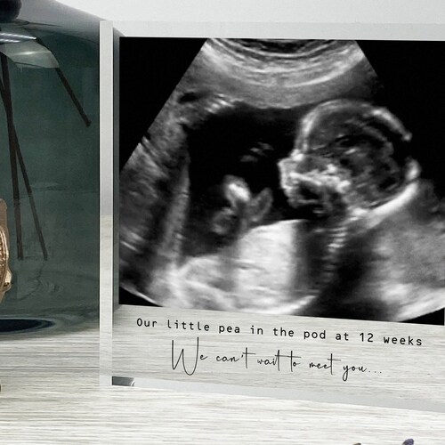 Baby Scan Photo Print Baby Scan Keepsake Baby Shower Gift | Etsy