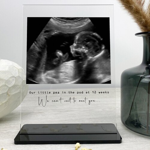 Baby Scan Photo Parents to Be Baby Scan Frame Baby Scan - Etsy