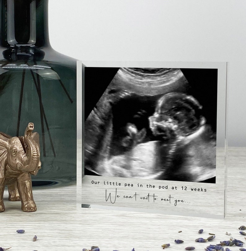 Baby Scan Photo Print, Baby Scan Keepsake, Baby Shower Gift, Baby Scan ...