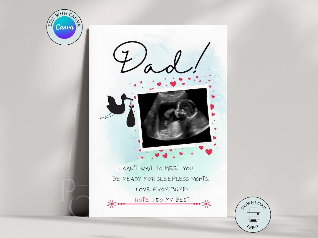 Personalized New Baby Pregnancy Announcement Scan Card Printable Baby ...