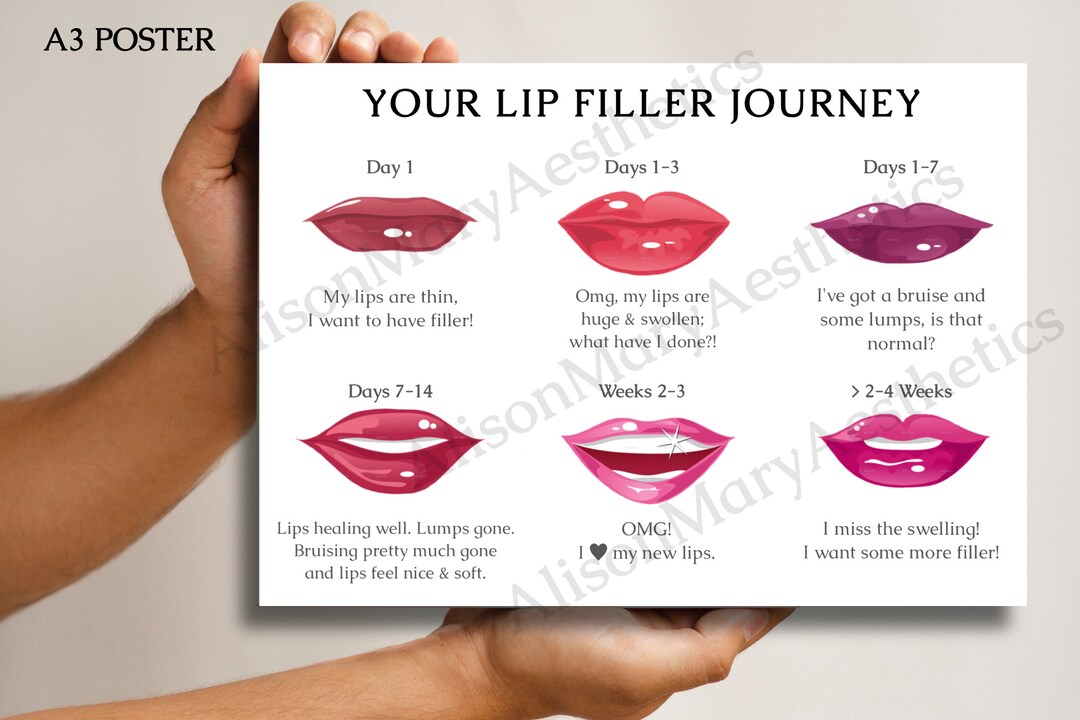 A3 Aesthetics 'lip Filler Journey' for Clients - DOWNLOAD ONLY - Etsy
