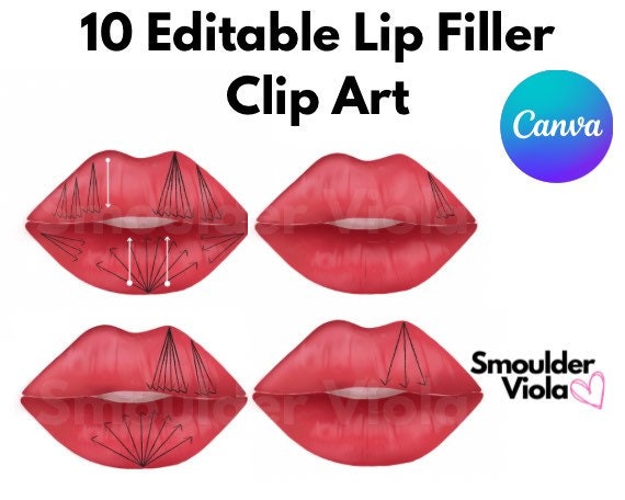 10 Lip Filler Illustrations for Training Manuals, Social Media Posts ...