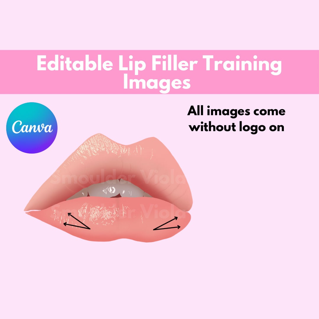 Lip Filler Training Images Clip Art Adjustable Arrows on - Etsy UK