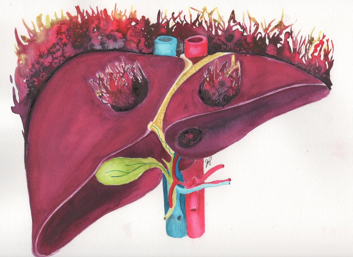 Liver on Fire - Etsy