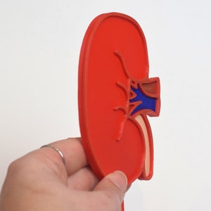 Kidney Cake Topper Kidney Transplant Kidney Gift Dialysis Medical Cake ...