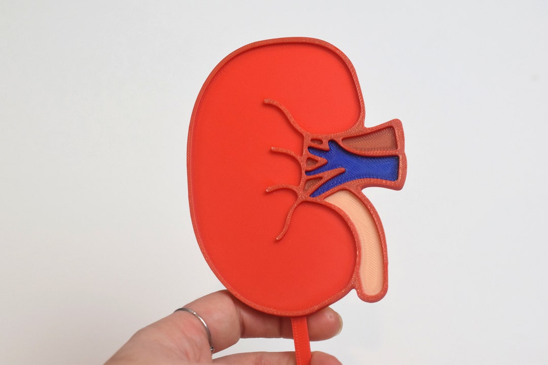 Kidney Cake Topper Kidney Transplant Kidney Gift Dialysis Medical Cake ...
