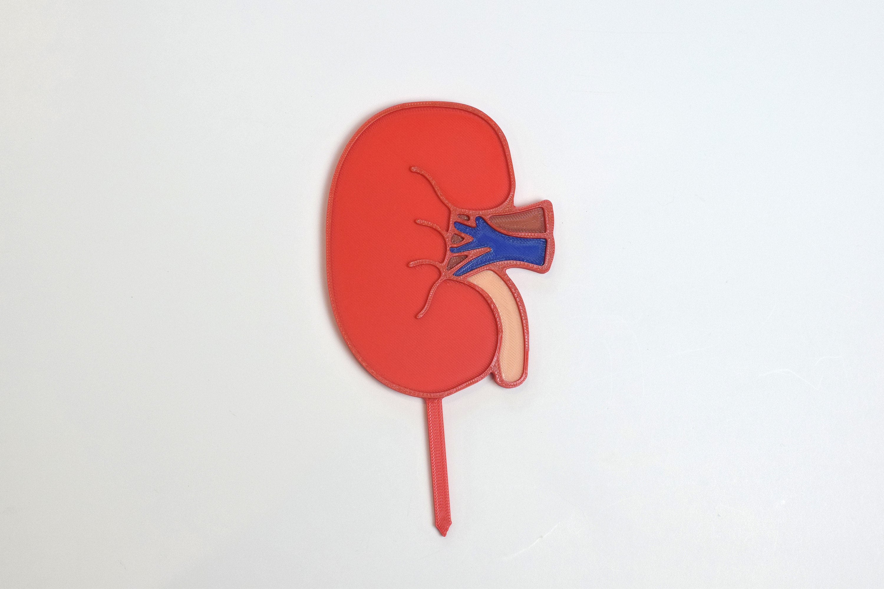 Kidney Cake Topper: Medical Party Decor Transplant Gift - Etsy