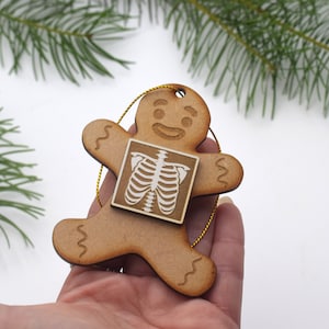 X-ray Gingerbread Man Ornament Radiology Xray Tech Radiologic ...