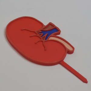 Kidney Cake Topper Kidney Transplant Kidney Gift Dialysis Medical Cake ...