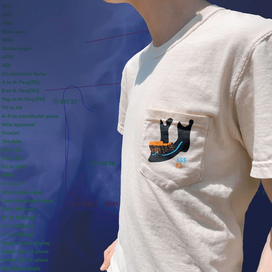 Orthognathic Jaw Surgery Tee Shirt Lefort 1 & BSSO Oral and ...