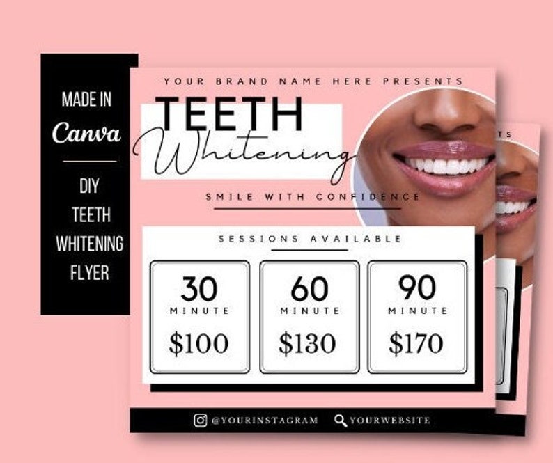 TEETH WHITENING FLYER Template Tooth Gems Appointment Flyer - Etsy