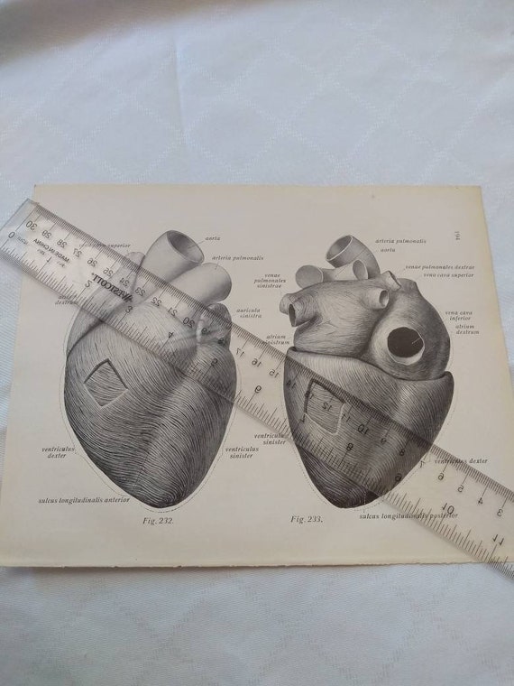 Heart Diagram Dissection Anatomy Drawing Vintage Medical | Etsy