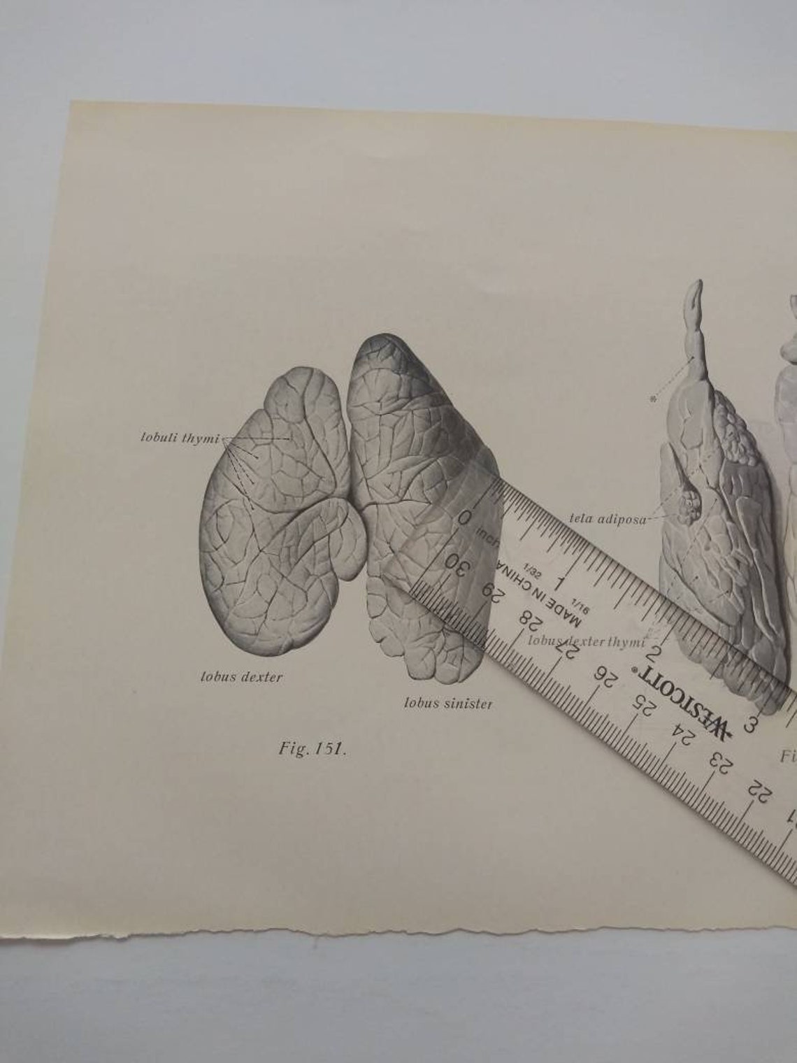Lungs Cross Section Diagram Dissection Anatomy Drawing Vintage - Etsy