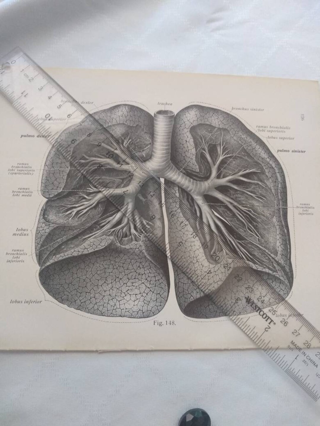 Lungs Cross Section Diagram Dissection Anatomy Drawing Vintage Medical ...
