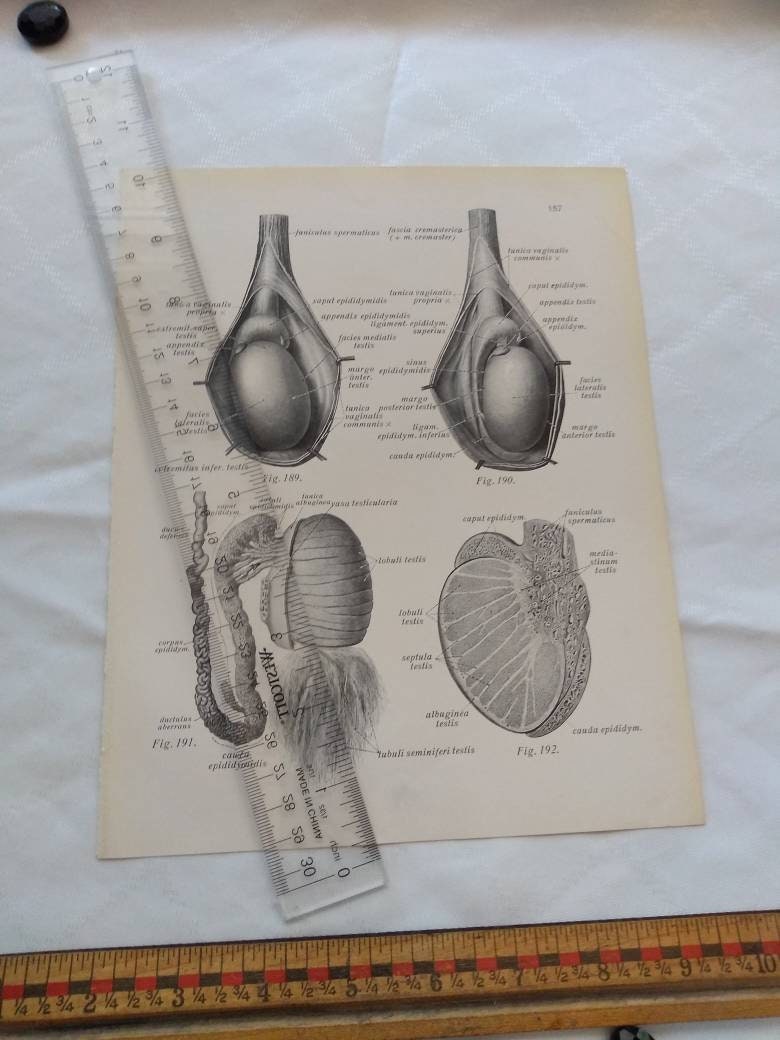 Testicules Testies Prostate Diagram Dissection Anatomy Drawing Vintage ...