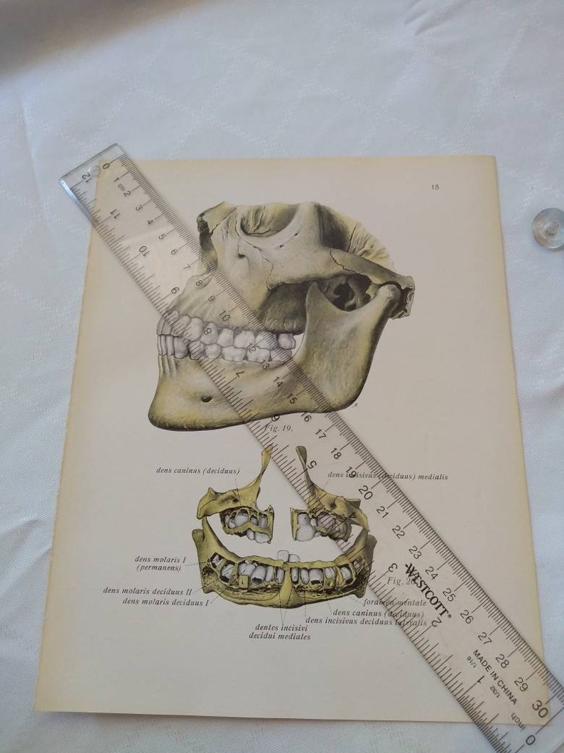 Skull Teeth Diagram Dissection Anatomy Drawing Vintage Medical - Etsy