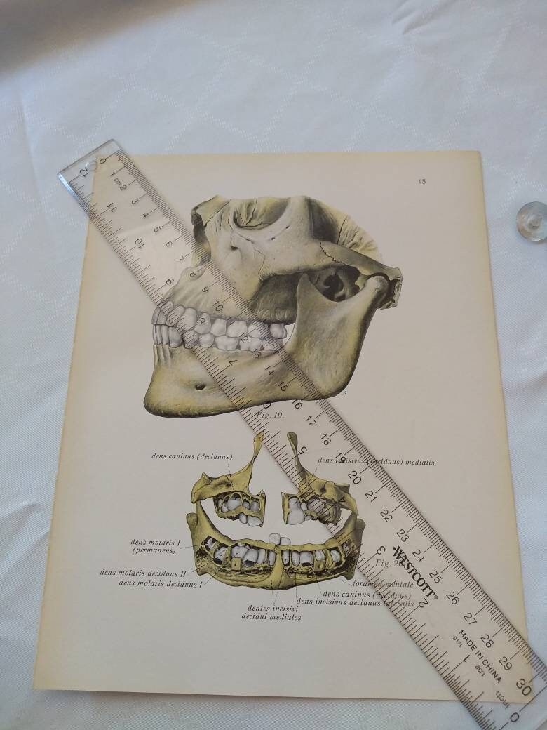 Skull Teeth Diagram Dissection Anatomy Drawing Vintage Medical - Etsy ...