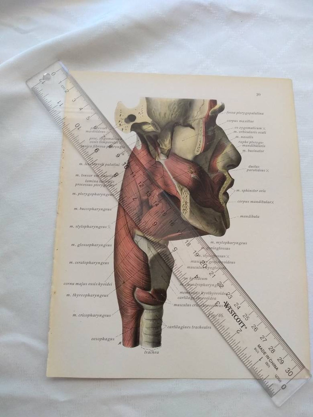 Back Side of Head Diagram Dissection Anatomy Drawing Vintage Medical ...
