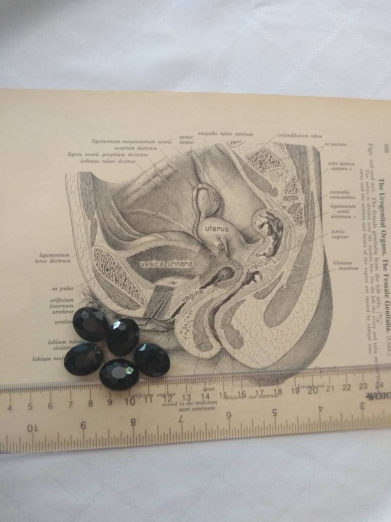 Nudity Fe/male Genitalia Uterus Vagina Front Diagram Dissection Anatomy Drawing Vintage Medical ...
