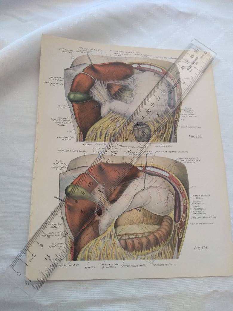 Liver and Stomac Diagram Dissection Anatomy Drawing Vintage Medical ...