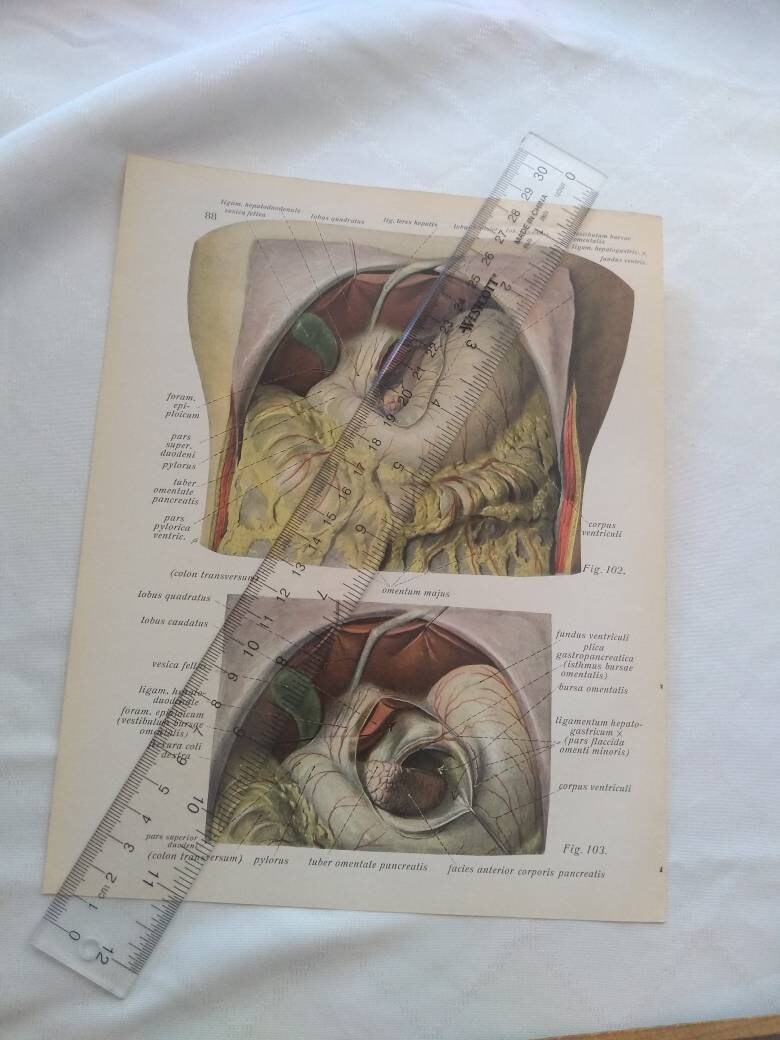 Liver and Stomac Diagram Dissection Anatomy Drawing Vintage Medical ...