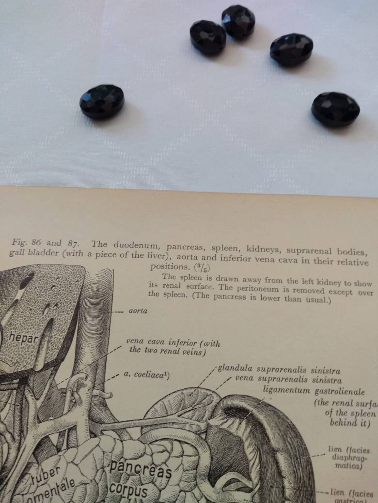 Pancreas Digestive Organs Diagram Dissection Anatomy Drawing Vintage ...