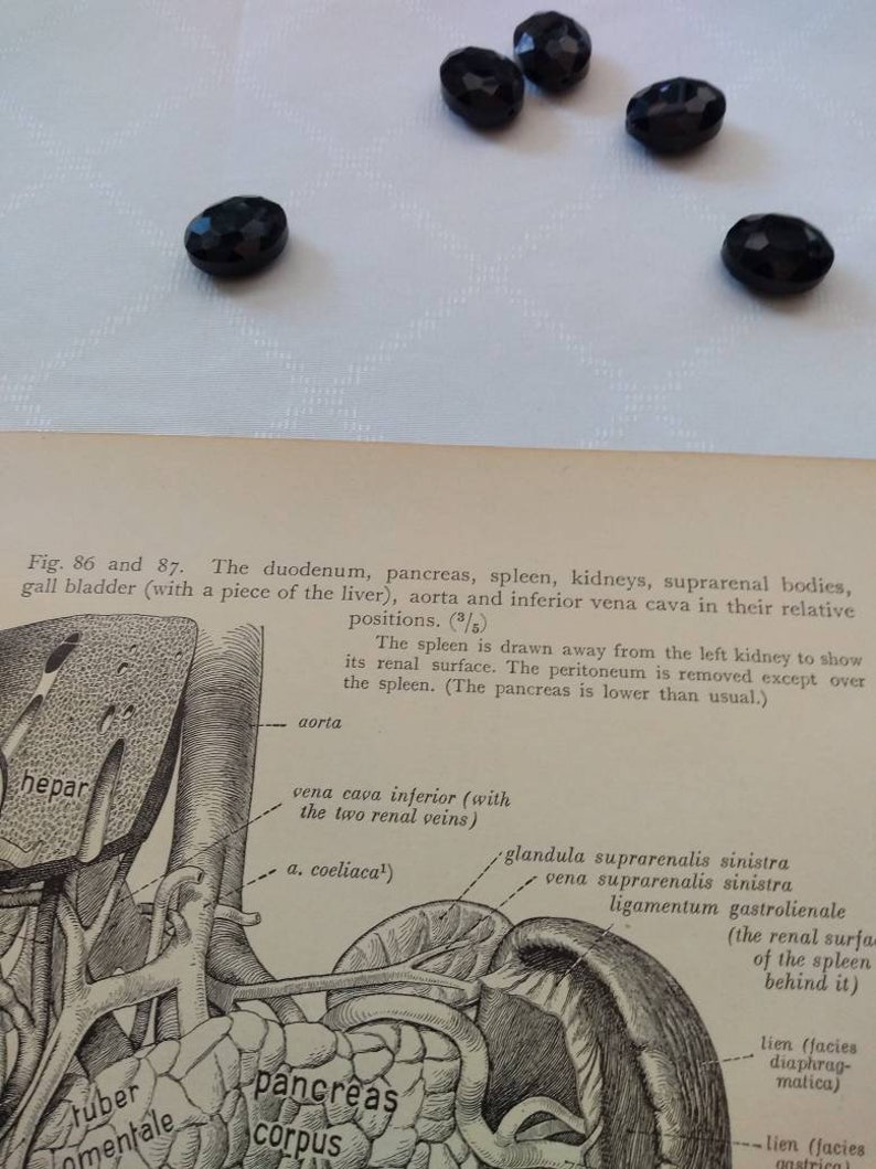 Pancreas Digestive Organs Diagram Dissection Anatomy Drawing Vintage ...