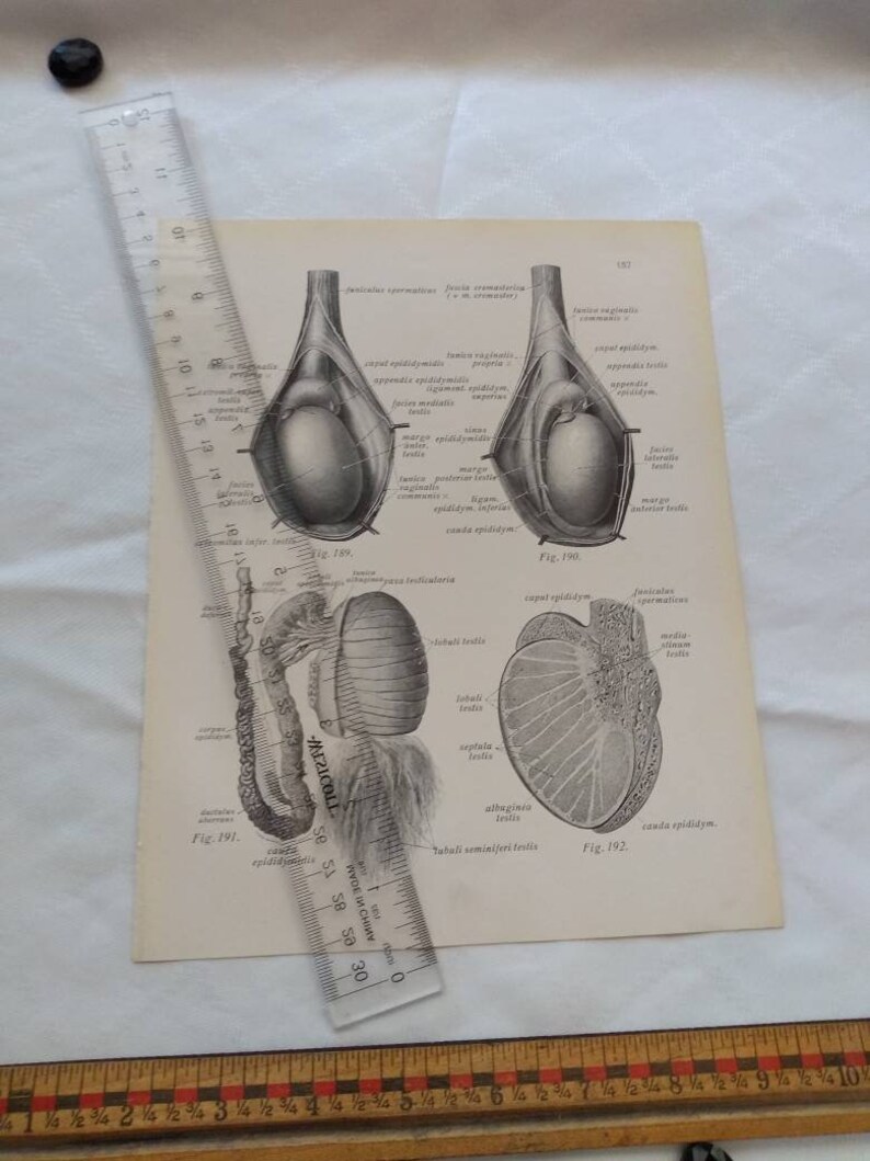 Testicules Testies Prostate Diagram Dissection Anatomy Drawing Vintage ...