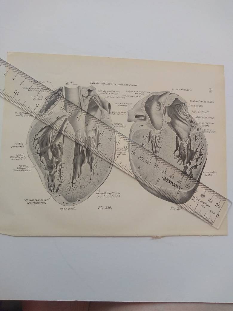 Heart Cross Section Diagram Dissection Anatomy Drawing Vintage Medical ...