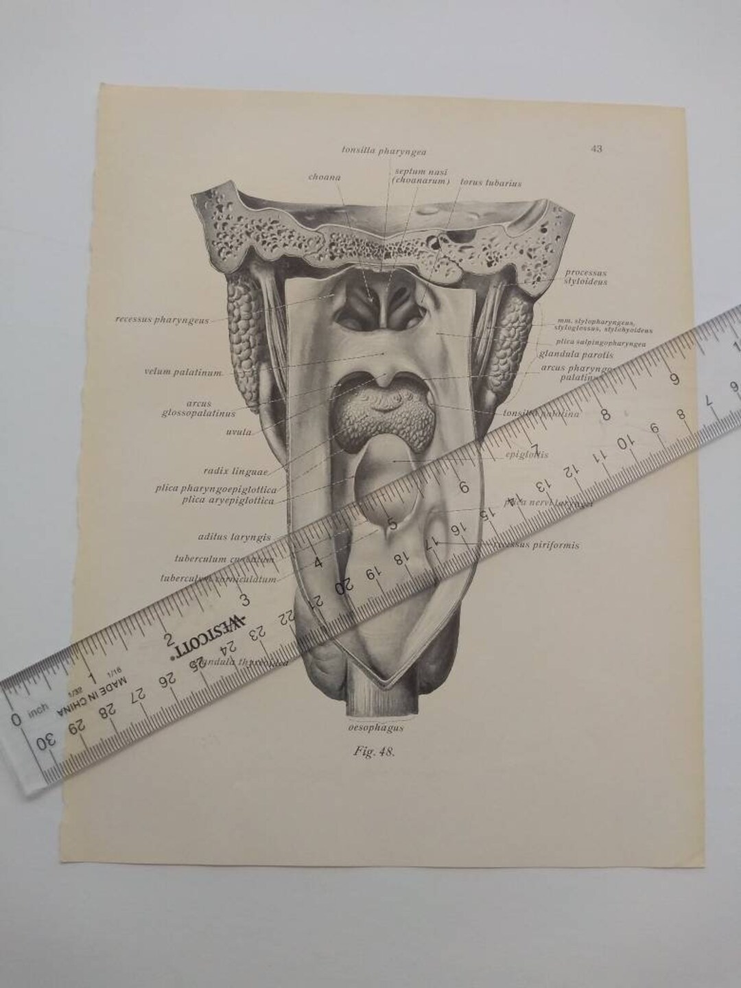 Troat Trachea Cross Diagram Dissection Anatomy Drawing Vintage Medical ...