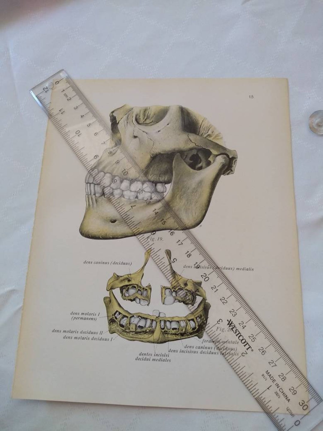 Skull Teeth Diagram Dissection Anatomy Drawing Vintage Medical Textbook ...