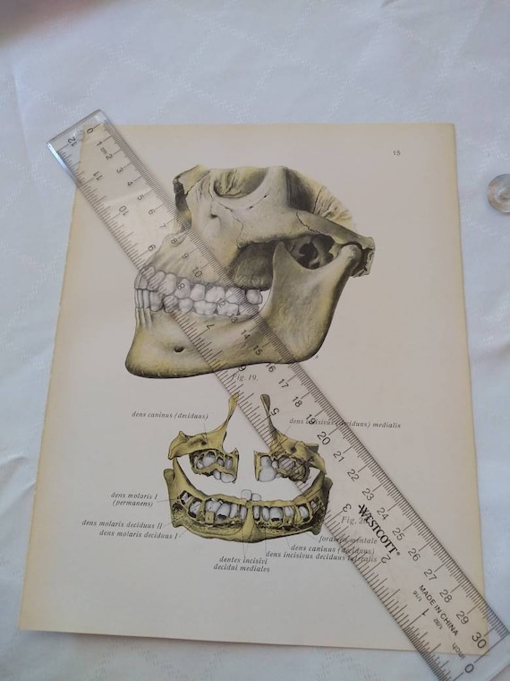 Skull Teeth Diagram Dissection Anatomy Drawing Vintage Medical - Etsy
