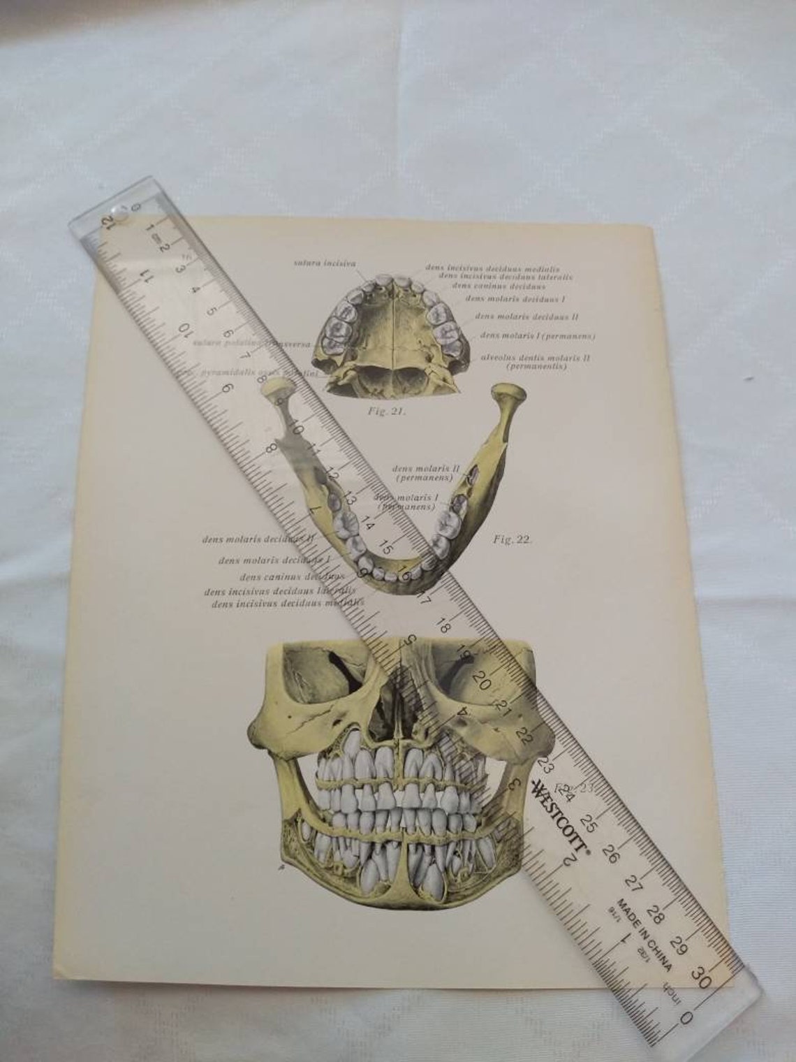 Skull Teeth Diagram Dissection Anatomy Drawing Vintage Medical - Etsy