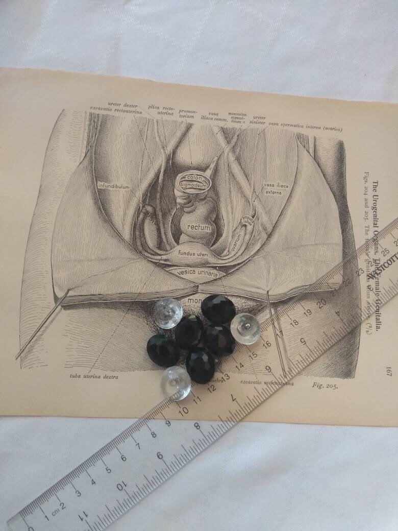 Nudity Fe/male Genitalia Uterus Vagina Front Diagram Dissection Anatomy Drawing Vintage Medical ...