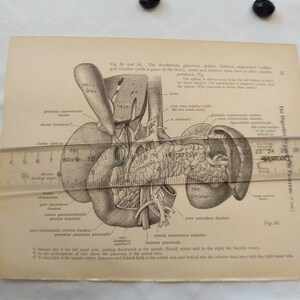 Pancreas Digestive Organs Diagram Dissection Anatomy Drawing Vintage ...