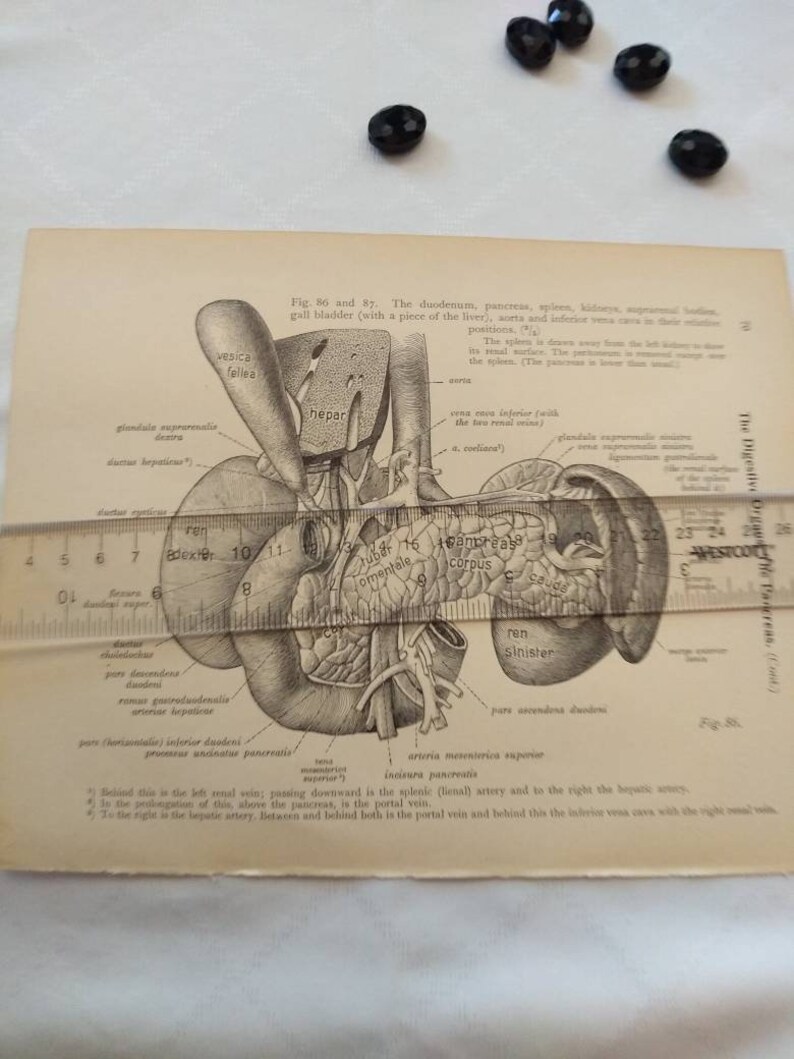 Pancreas Digestive Organs Diagram Dissection Anatomy Drawing Vintage ...