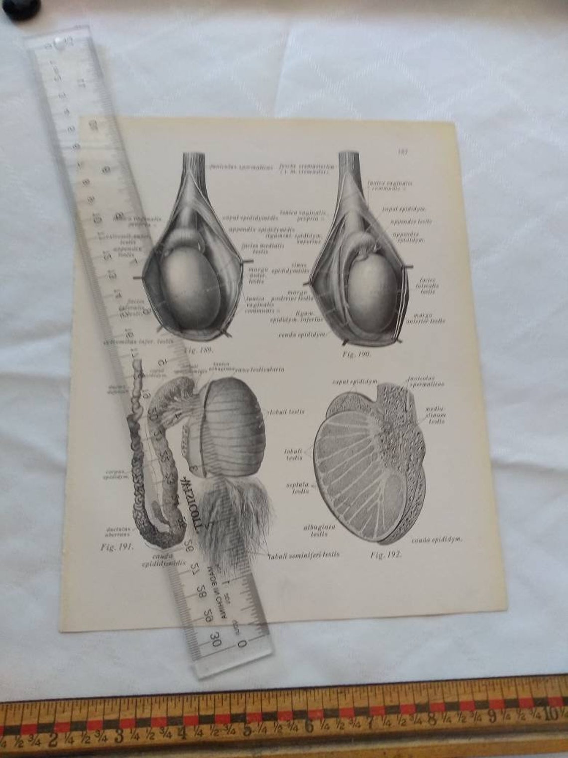 Testicules Testies Prostate Diagram Dissection Anatomy Drawing Vintage ...