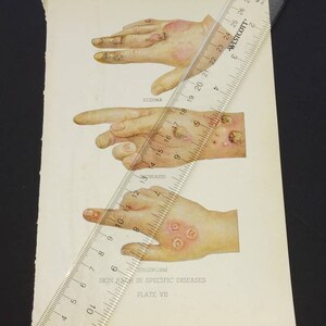 Skin Rash in Specific Disease Print Infection Medical Book Library ...