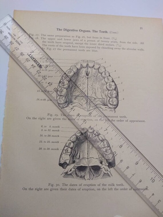 Teeth Cross Section Diagram Dissection Anatomy Drawing Vintage - Etsy