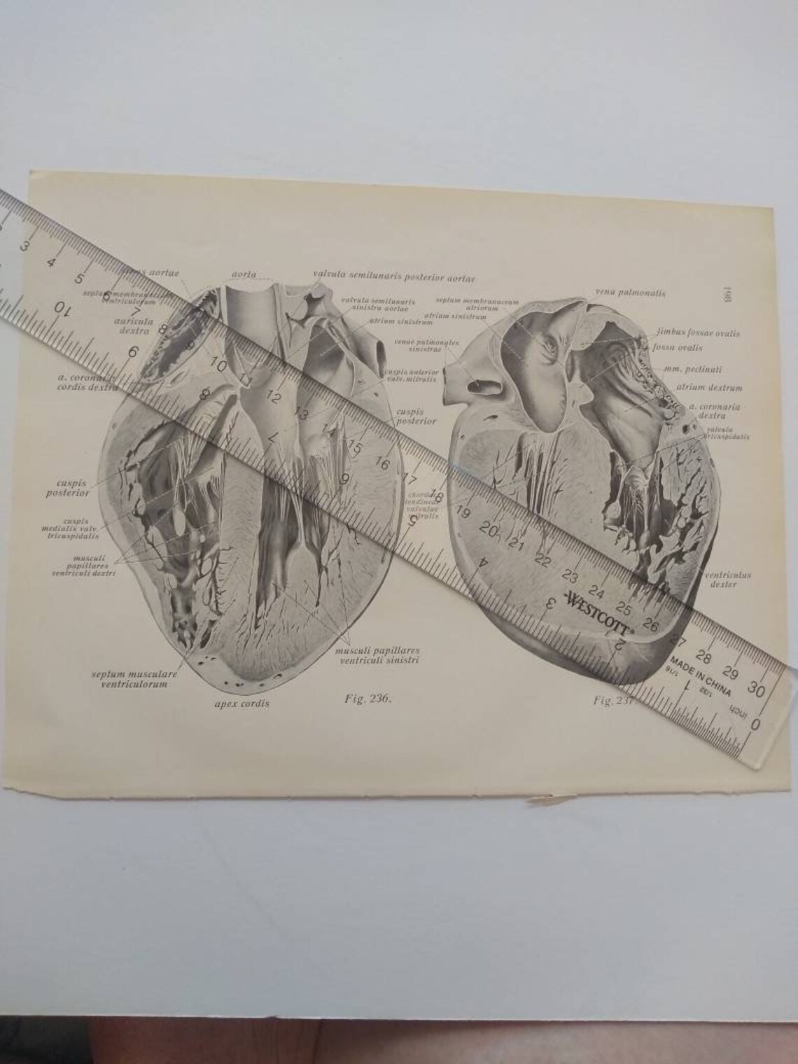 Heart Cross Section Diagram Dissection Anatomy Drawing Vintage - Etsy