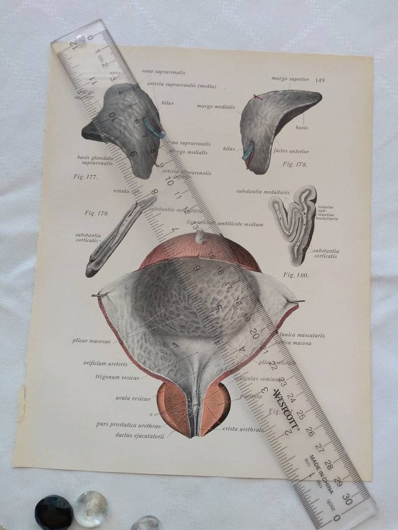 Bladder Urinary Track Prostate Diagram Dissection Anatomy Drawing Vintage Medical Textbook Print ...