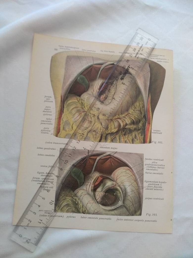 Liver and Stomac Diagram Dissection Anatomy Drawing Vintage Medical ...